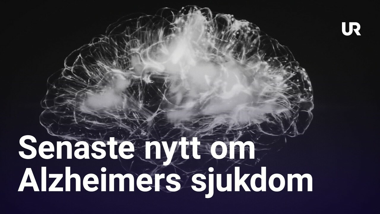 Svenska demensdagarna 2024: Senaste nytt om Alzheimers sjukdom | UR Play